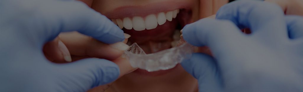 ORTHODONTICS - Belladent Dental Labs